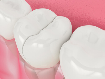 Cracked Tooth Pain: What is it and When to Seek Treatment
